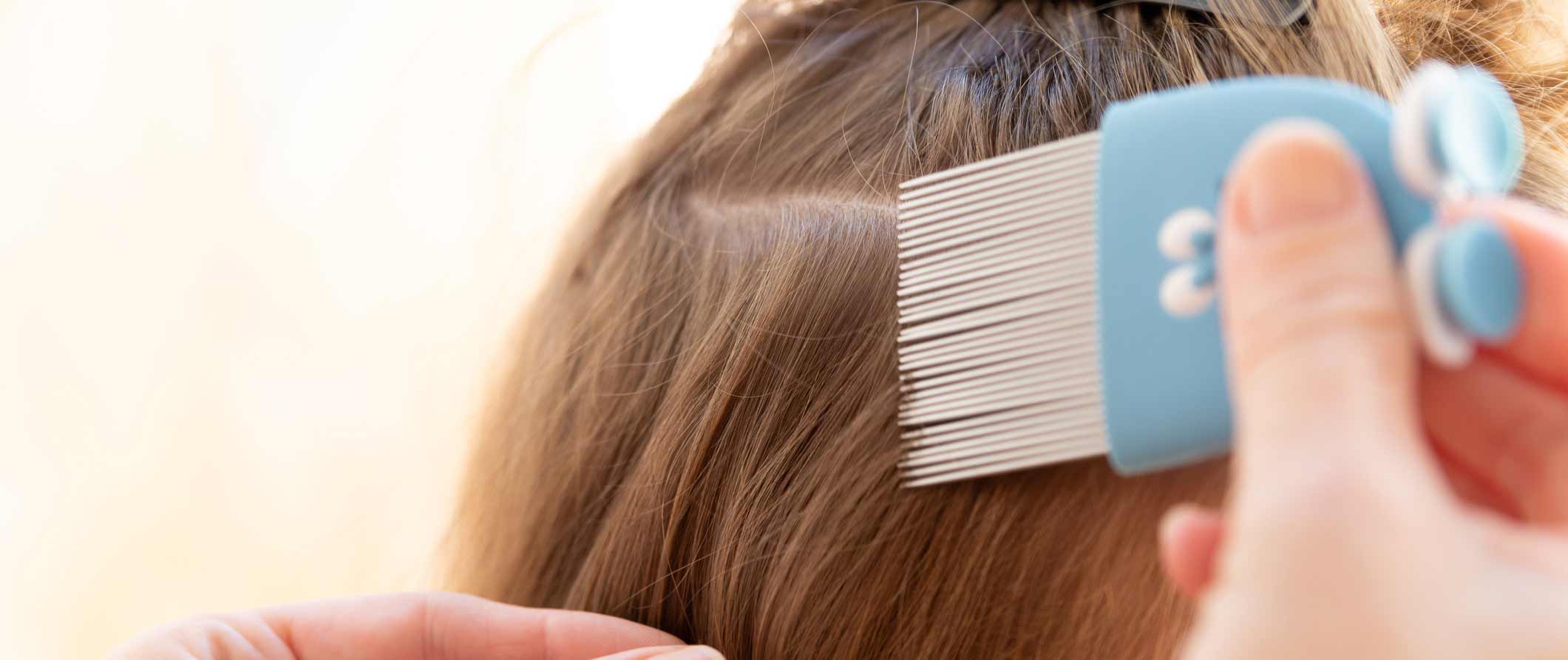 Green Hills Pediatric Associates | Treating Head Lice
